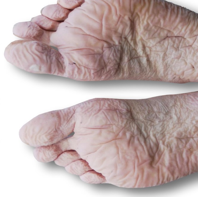 Foot Care: How to Keep Your Feet Walking - Survival Dispatch